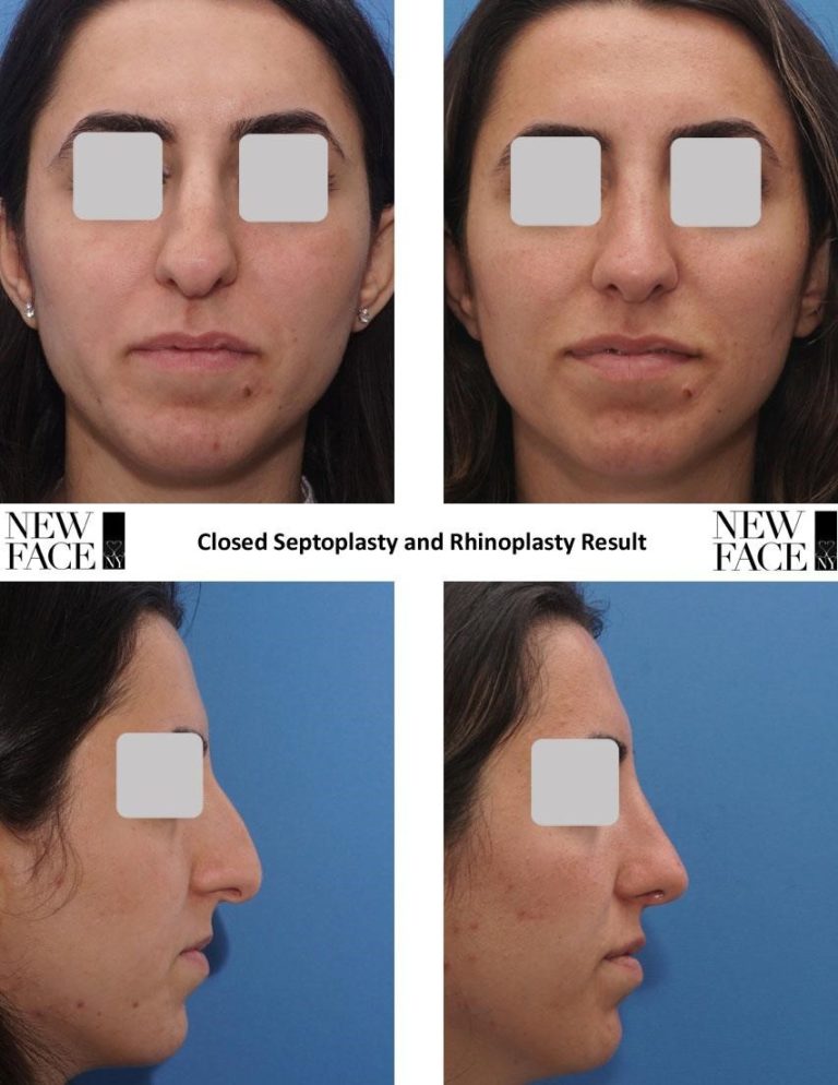 Seeing through the Envelope: The Cartilage Shape Requirements for an ...