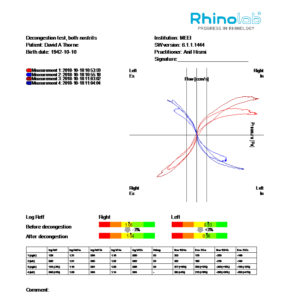 Objective Measures of Nasal Airway Obstruction - Rhinoplasty Archive